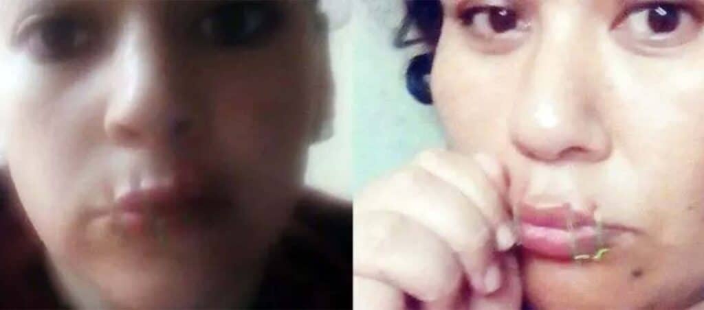 Se cosieron la boca en señal de reclamo | La Super Digital